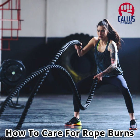 How To Take Care Rope Burns – Callus Performance
