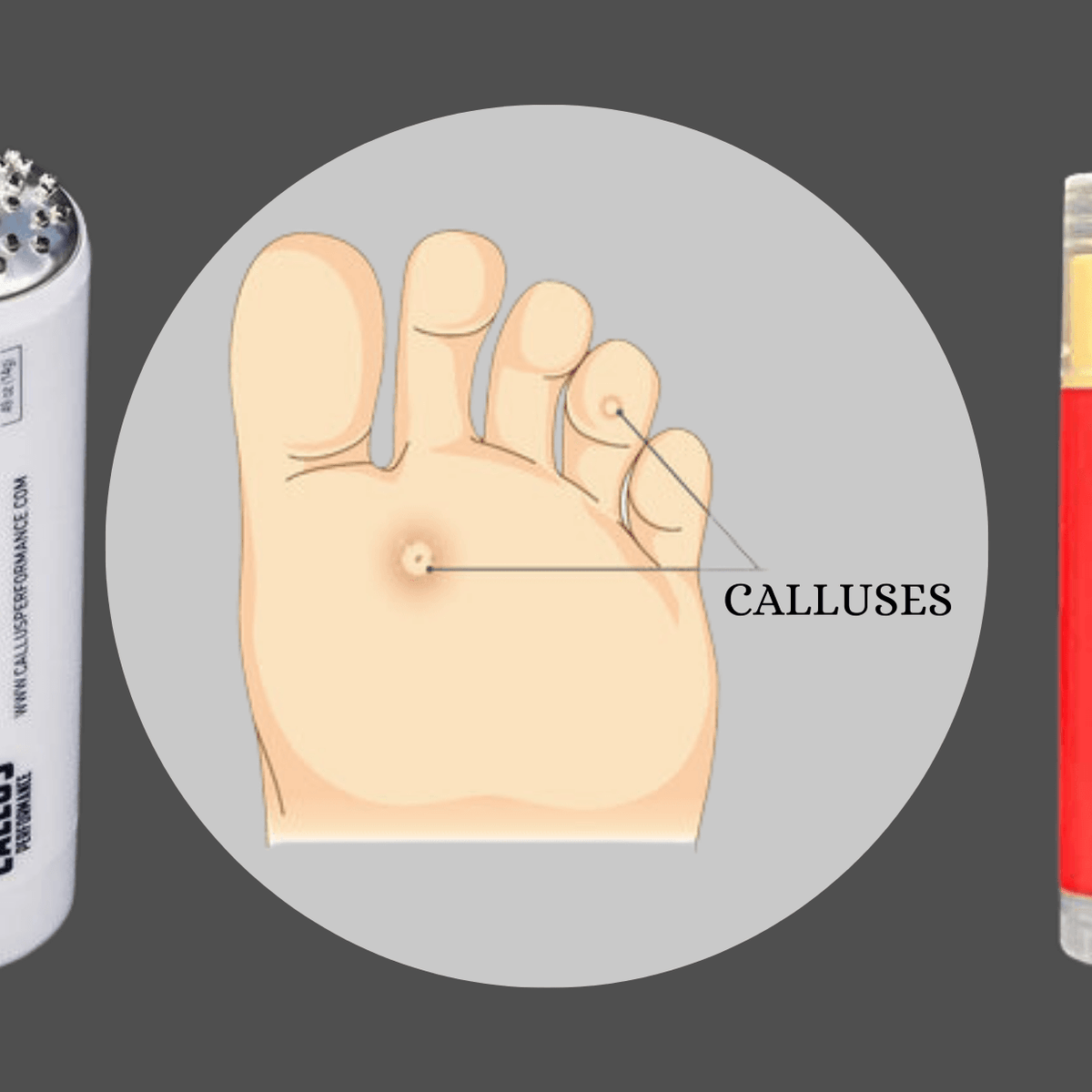 Learn about the best callus remover and treatment for callus – Callus ...