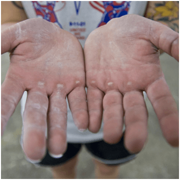 How to Trim Calluses on your Hands & Feet – Callus Performance